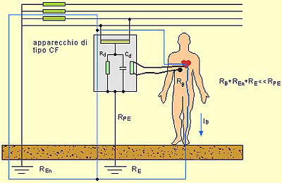 Circuiti che presentano il pericolo di microshock - Voltimum IT
